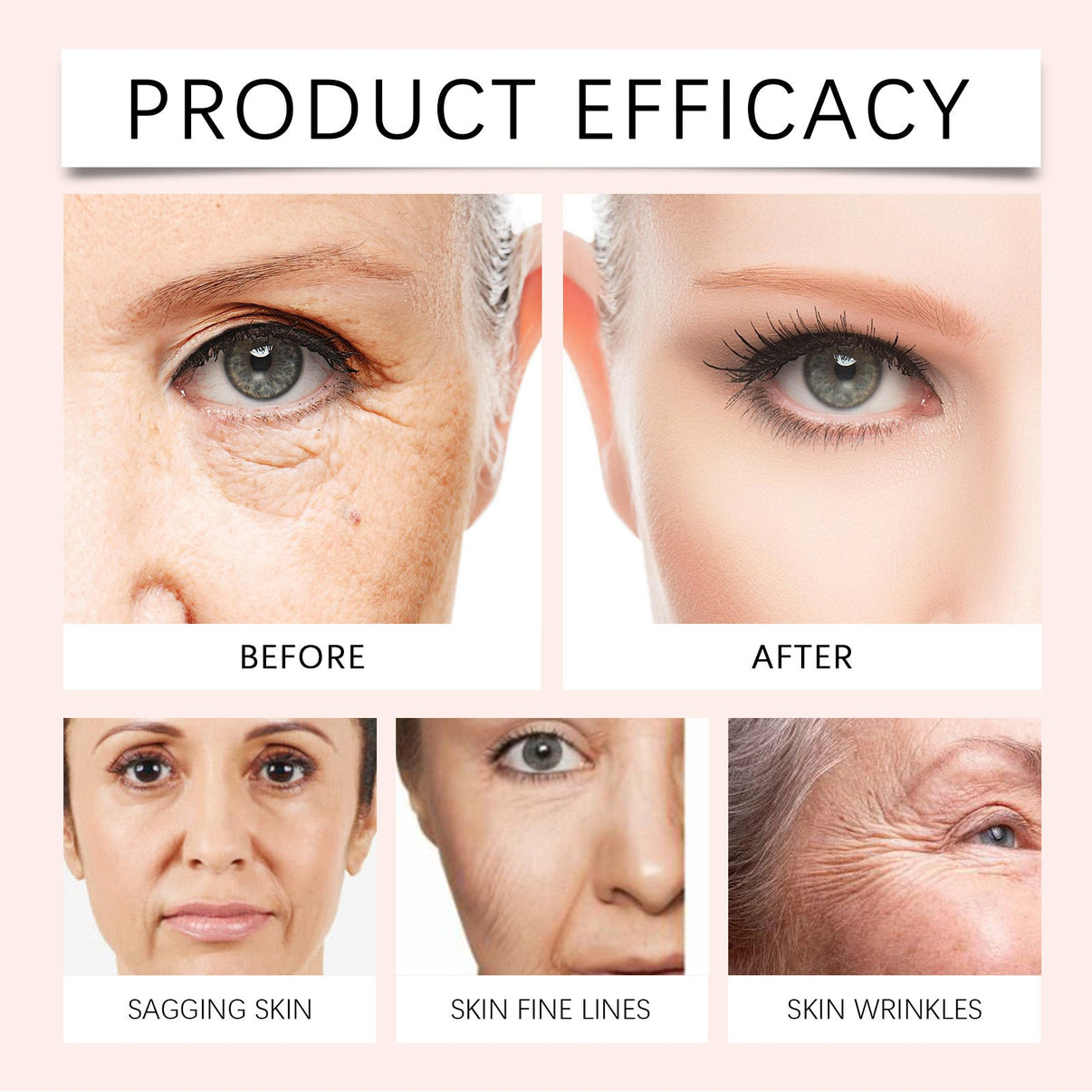 Wrinkle Fix – GLIZM